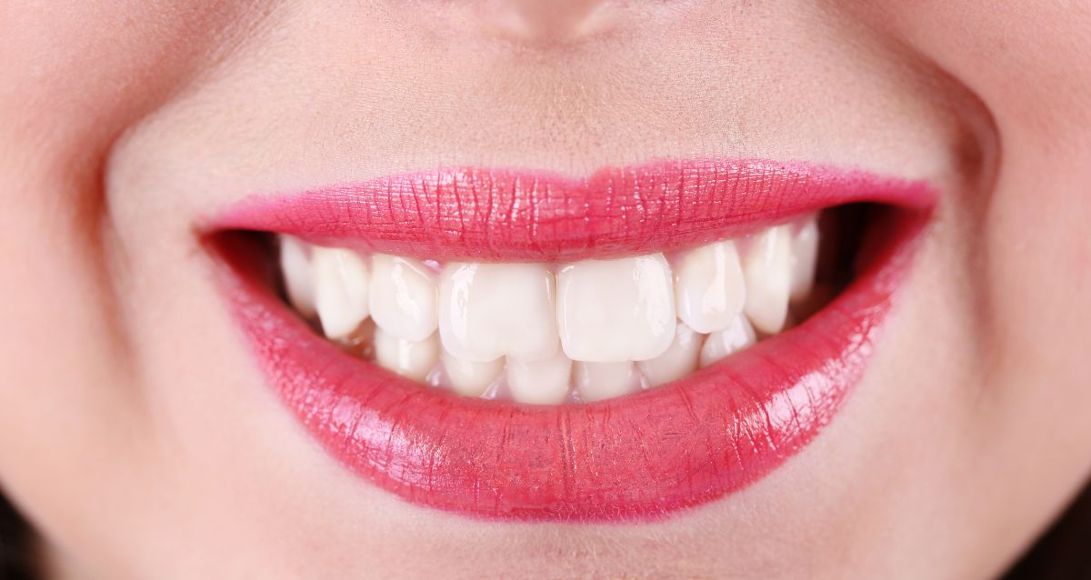Six Month Smiles - Forest Dental Care